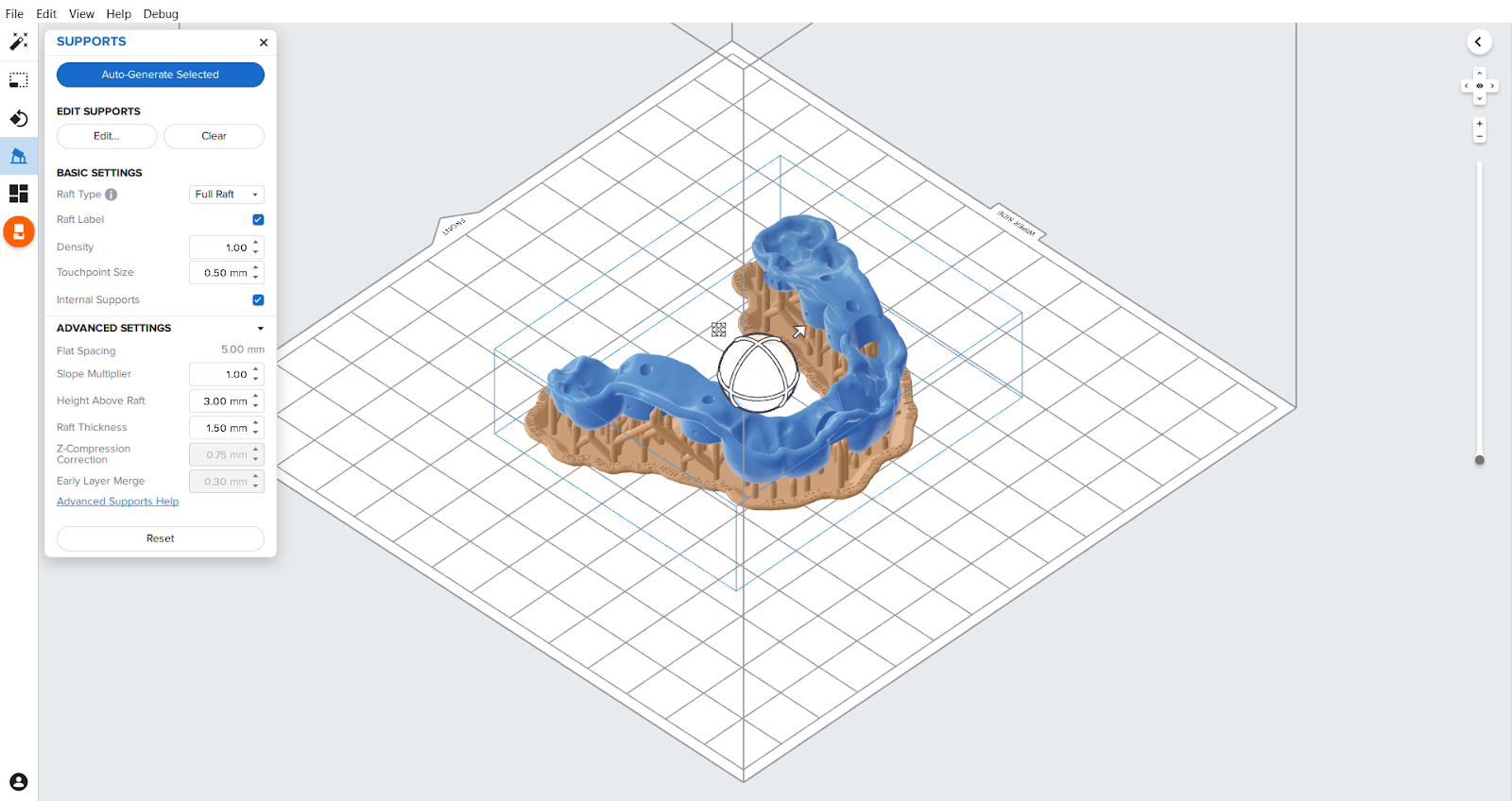 Using Surgical Guide Resin